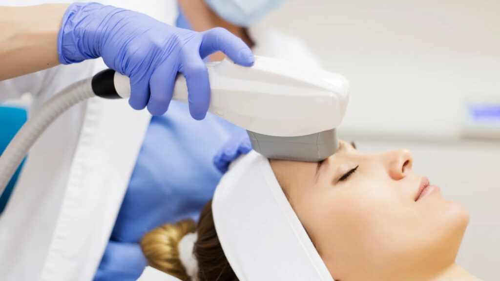 IPL - Neck & Chest | The Best You