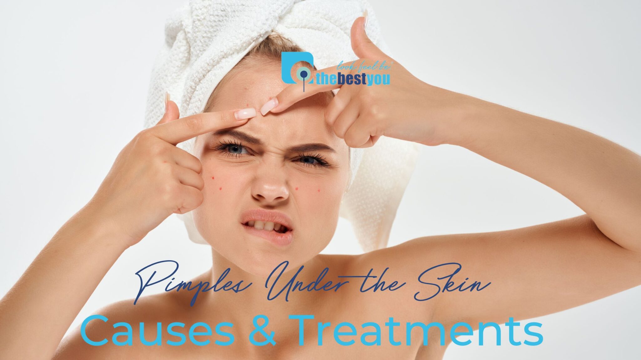 Pimples Under the Skin: Causes and Treatments